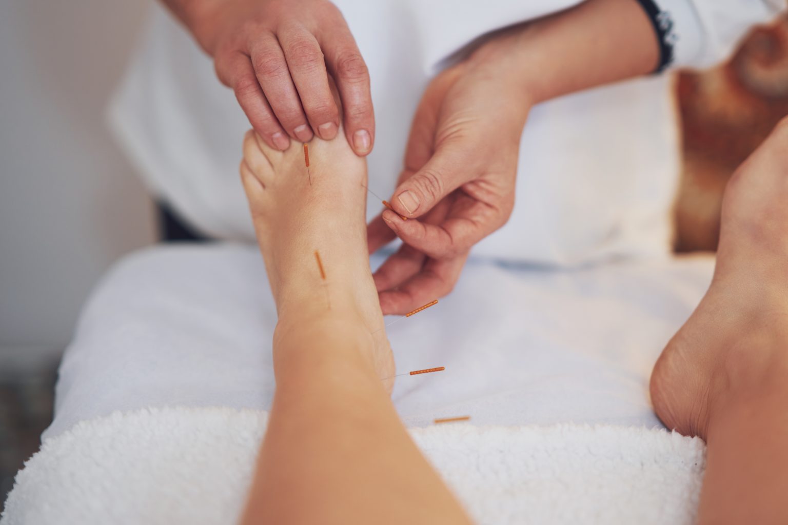 Welcome to Impact Dry Needling Clinic in Perth